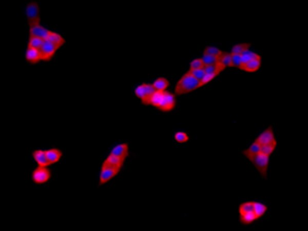 INS-1E Rat Insulinoma Beta Cell Line | SCC491